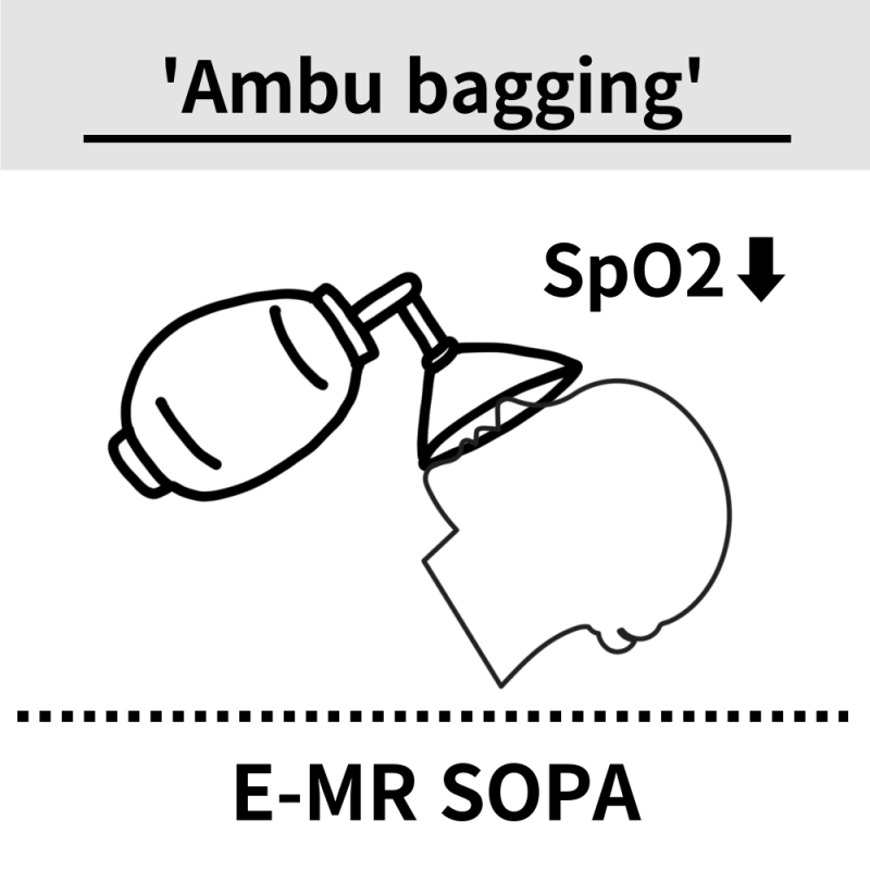 응급상황에서의 기관삽관(Intubation) : RSI(Rapid Sequence Intubation) : 네이버 블로그