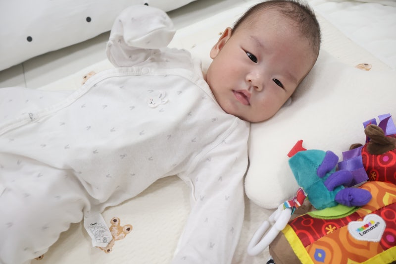 신생아 연어반 치료 필수 원인 및 아기 딸기혈관종 차이점 네이버 블로그