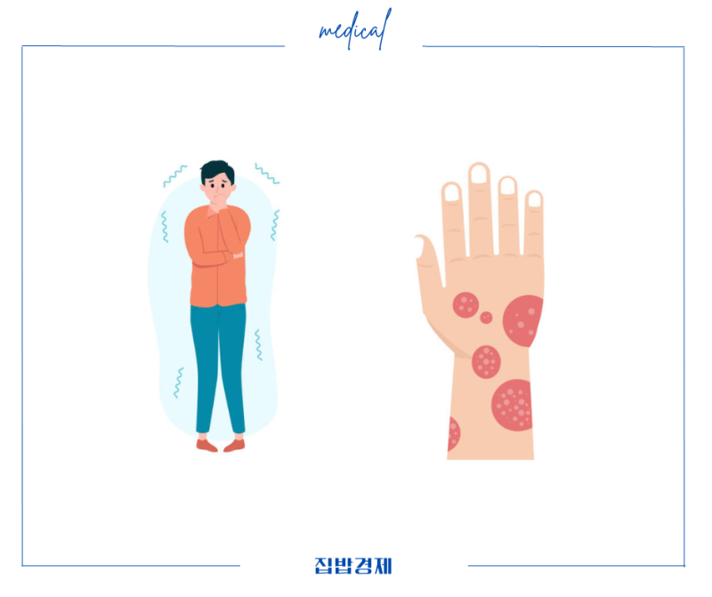 싱그릭스 대상포진 예방접종 가격 및 부작용과 간격 알아보기 네이버 블로그