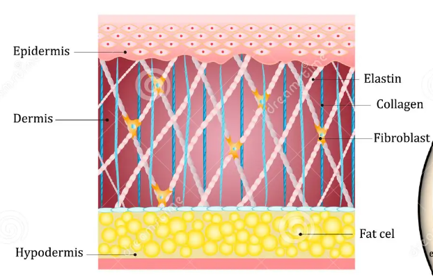 피부과 전문의와 알아보는 튼살(Stretch Mark, Striae) 해결방법 : 네이버 블로그