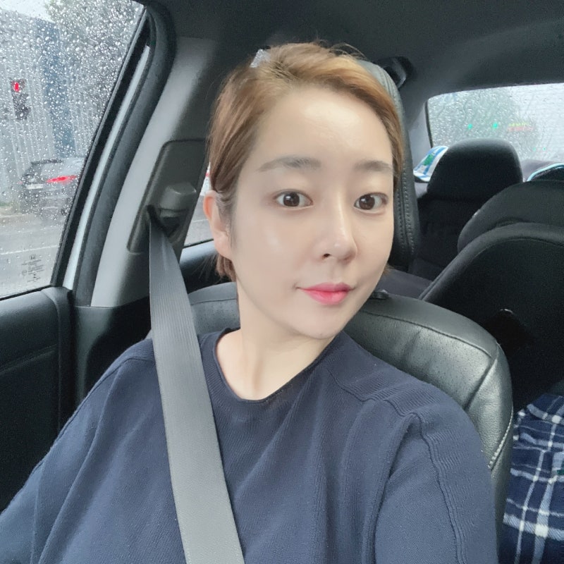 논현역피부과 큐티필 feat. 팔자주름필러 + 콧대필러 + 보톡스 대만족 후기 : 네이버 블로그