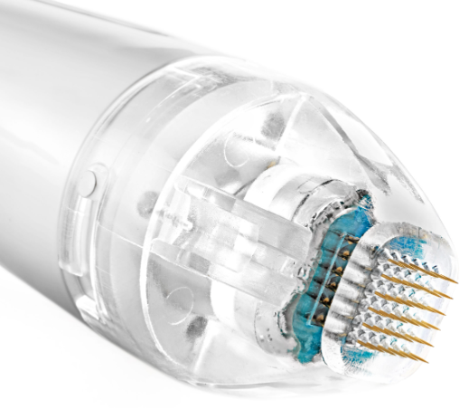 피부과 전문의와 알아보는 튼살(Stretch Mark, Striae) 해결방법 : 네이버 블로그