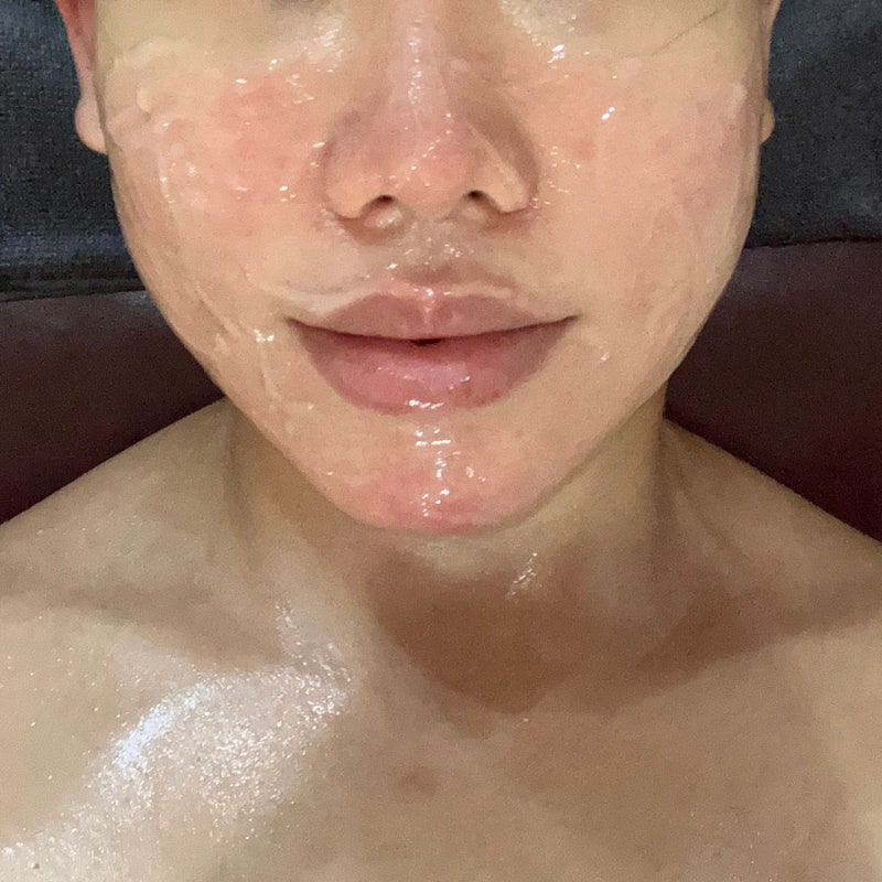 대구 칠곡 학정동 칠곡피부관리 예민피부관리 정명순내면미용 네이버 블로그