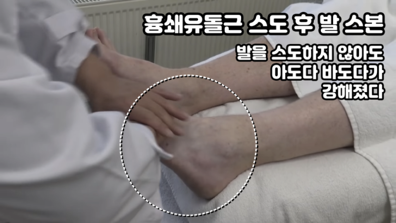 403. 5년 된 심부전증 KSNS KSS 눈으로 보는 스본과 스도 : 네이버 블로그