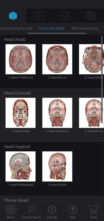 내돈내산 해부학 어플 리뷰 : 3D 아틀라스, Human anatomy, Complete anatomy, Muscle ...