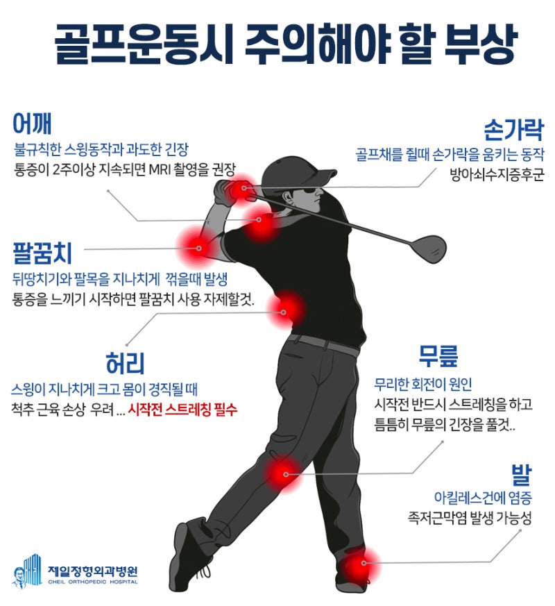 골프 후 발생하는 허리 통증 골프허리통증 외에도 발생할 수 있는 증상은 Feat 척추센터 강태욱 원장 네이버 블로그