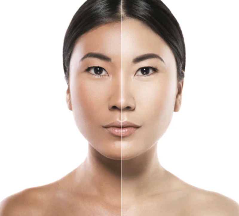 피부 And 얼굴 하얘지는법 팩트 방법 정리 네이버 블로그