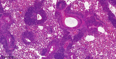 Hematoxylin&Eosin Staining (H&E 염색) - Part3. 실험과정(Protocol) : 네이버 블로그