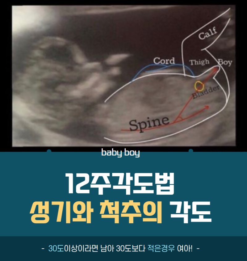 태아 성별 확인 시기 12주 각도법 아기 난황위치 베이킹소다 성별 네이버 블로그