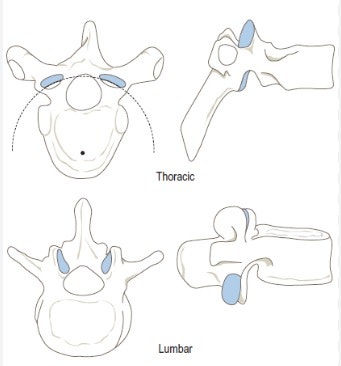 흉요추증후군 ( TL junction syndrome, Maigne syndrome) : 네이버 블로그