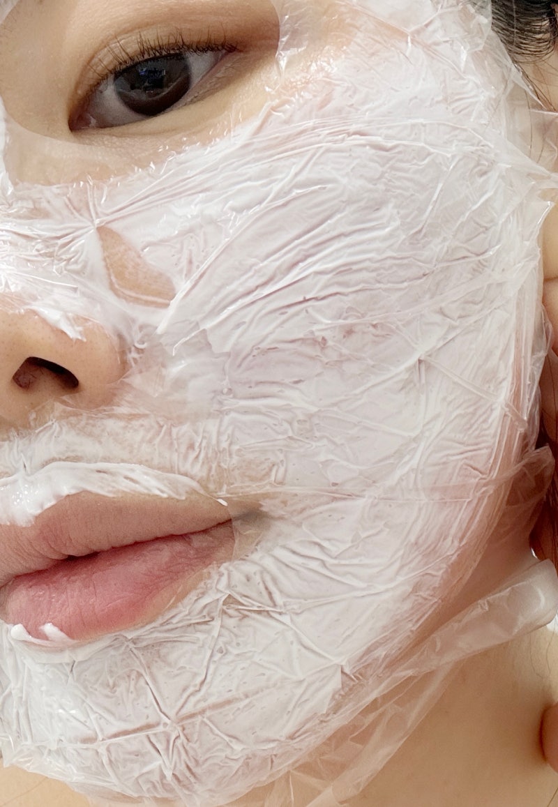 내돈내산 피부과 스킨부스터 쥬베룩 하이쿡스 시술 Vs 볼륨 가격비용 한 달 효과 주의사항 후기 네이버 블로그