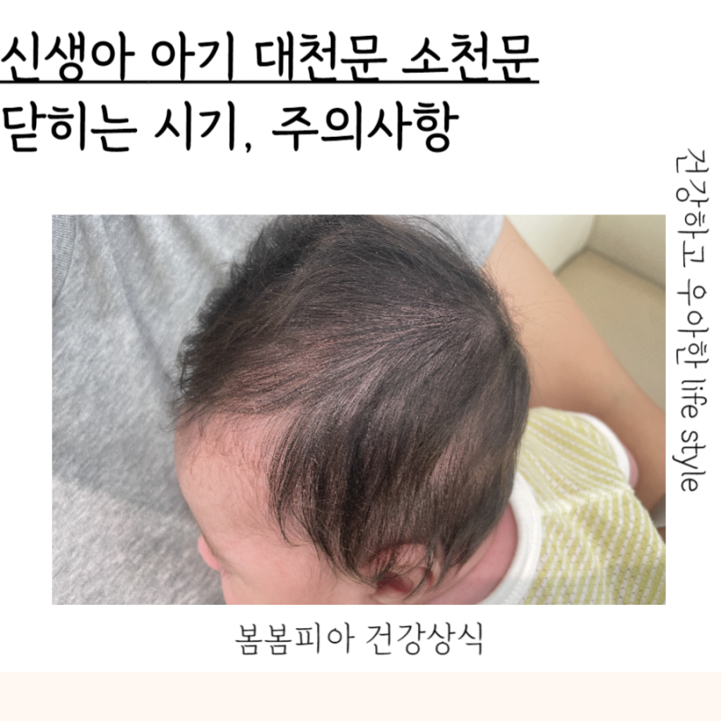 신생아 아기 대천문 닫히는 시기 소천문 위치 숨구멍 주의사항 네이버 블로그
