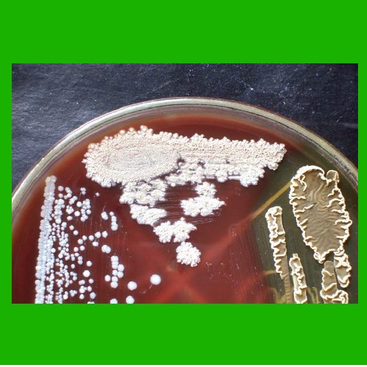 MRSA, MRAB, VRE, CRE culture 결과 보는 법 : 네이버 블로그