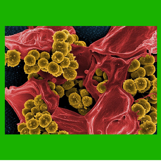 MRSA, MRAB, VRE, CRE culture 결과 보는 법 : 네이버 블로그