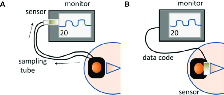 마취과) ETCO2(End-Tidal concentration of Carbon Dioxide)의 모든 것.(레퍼런스 참조 ...