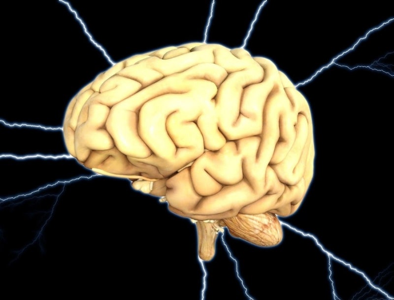치매검사(CERAD-K, SNSB-2 검사) 특징 방법 비용 참고사항 모두 설명 : 네이버 블로그