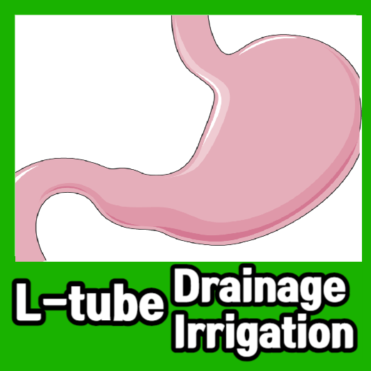 L-tube irrigation Drainage 환자 준비물 방법 : 네이버 블로그