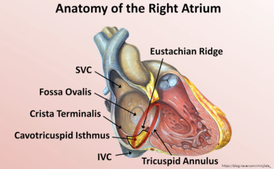 심방조동 atrial flutter AFL 심전도 증상 치료 (+ 심방세동 atrial fibrillation AF 차이점 ...