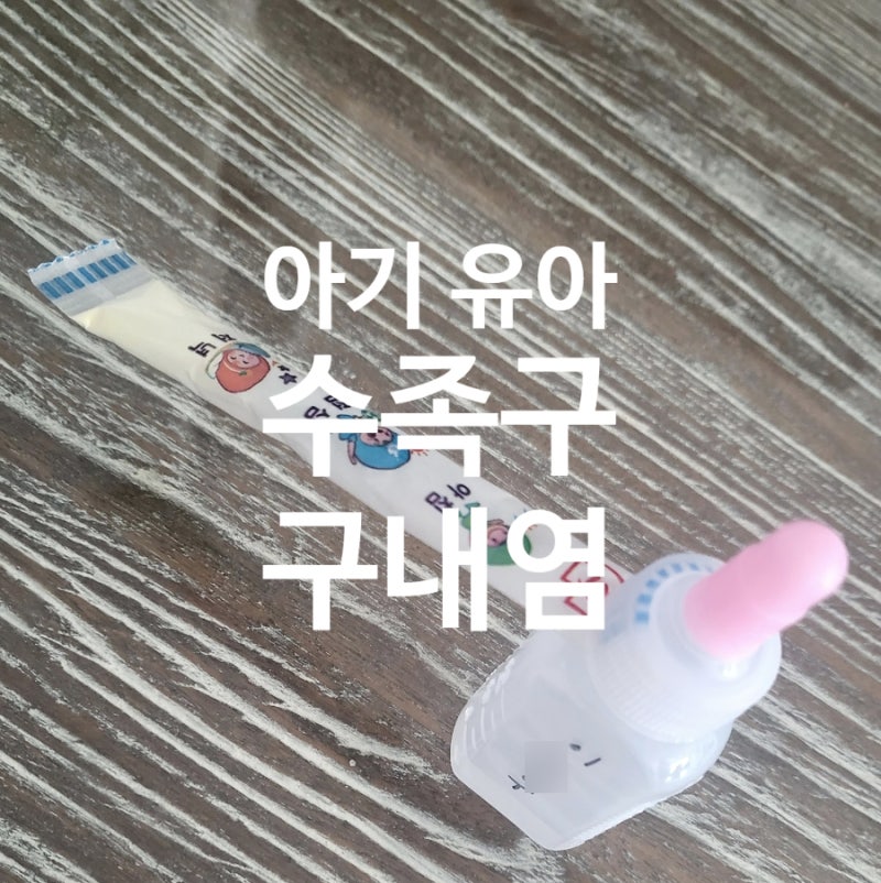 아기 유아 수족구 구내염 증상 열 입안 수포 네이버 블로그
