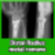 Distal Radius metal remove HWR 수술 : 네이버 블로그