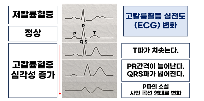 고칼륨혈증 원인과 증상 치료 Hyperkalemia 네이버 블로그