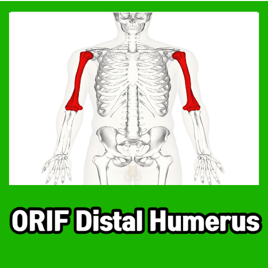 ORIF Distal Humerus 수술 준비 및 수술과정 : 네이버 블로그