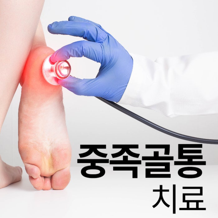 반포 정형외과 발바닥 앞쪽의 통증 중족골통 원인 네이버 블로그