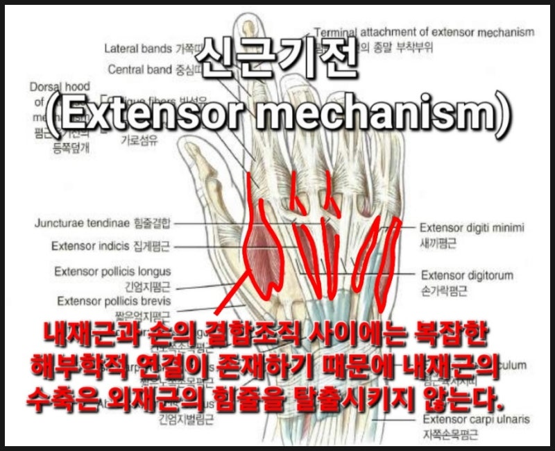 방아쇠수지증후군trigger Finger 손가락 딸깍 소리 원인 및 치료 방법 네이버 블로그