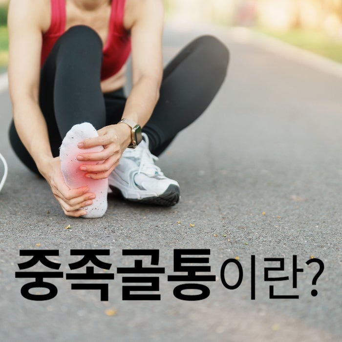 반포 정형외과 발바닥 앞쪽의 통증 중족골통 원인 네이버 블로그