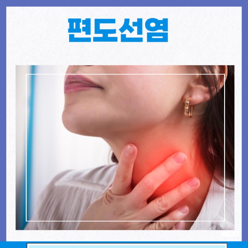 급성 편도염 증상 원인 편도부었을때 전염 만성 열 세균성 아이스크림 편도선염 빨리낫는법 네이버 블로그