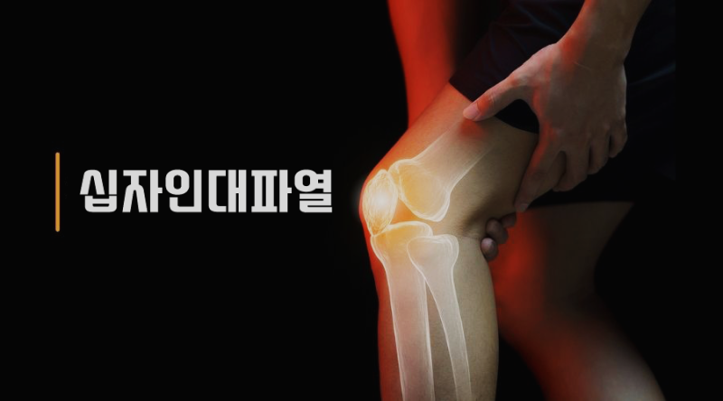 전방 십자인대 파열 증상 수술 후 손상 통증 재활 방법 네이버 블로그