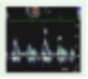TTE 의학용어 echo 검사 결과 해석 RWMA EF E/e' 의미 Transthoracic Echocardiography ...