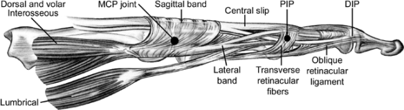 [정형외과 전문의] 신전건 파열, Extensor tendon injury (수부외과) : 네이버 블로그