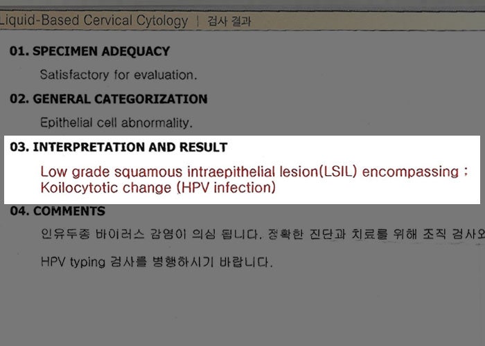 LSIL, HSIL 등 자궁경부 세포진 검사 결과 해석과 치료 (HPV) : 네이버 블로그