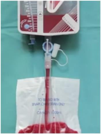 SINAPI Chest drain bottle 시나피 : 네이버 블로그