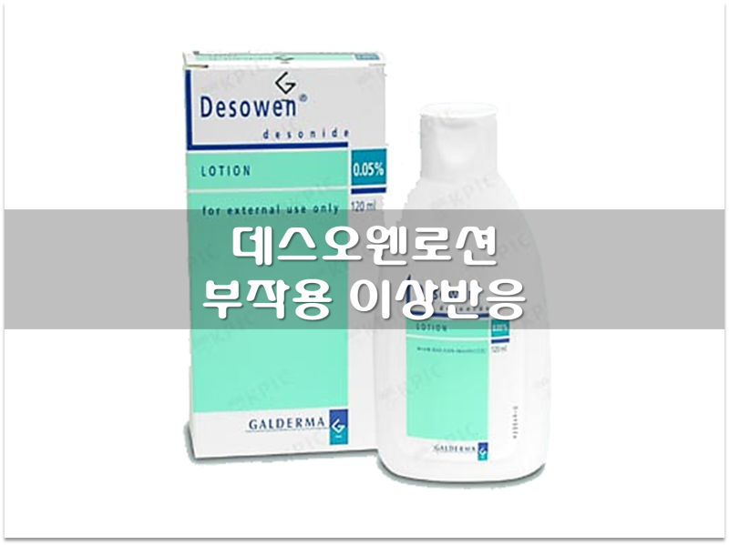 데스오웬 데스오웬로션 005 스테로이드 로션 피부질환 가려움 염증 처방 약 치료제 효능 효과 성분 부작용 사용법 네이버 블로그