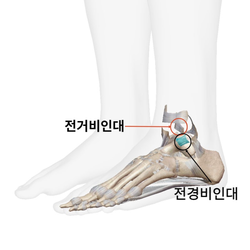 발목을 자주 다쳐요 안산 발목 염좌 한방진료 테이핑 네이버 블로그