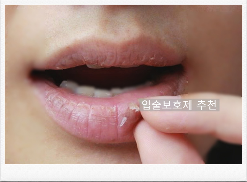 입술 뜯는버릇 갈라짐 껍질 각질 제거 관리 립마스크 입술건조증 올리브영 남자 컬러 발색 비건 틴트 립밤 추천 네이버 블로그