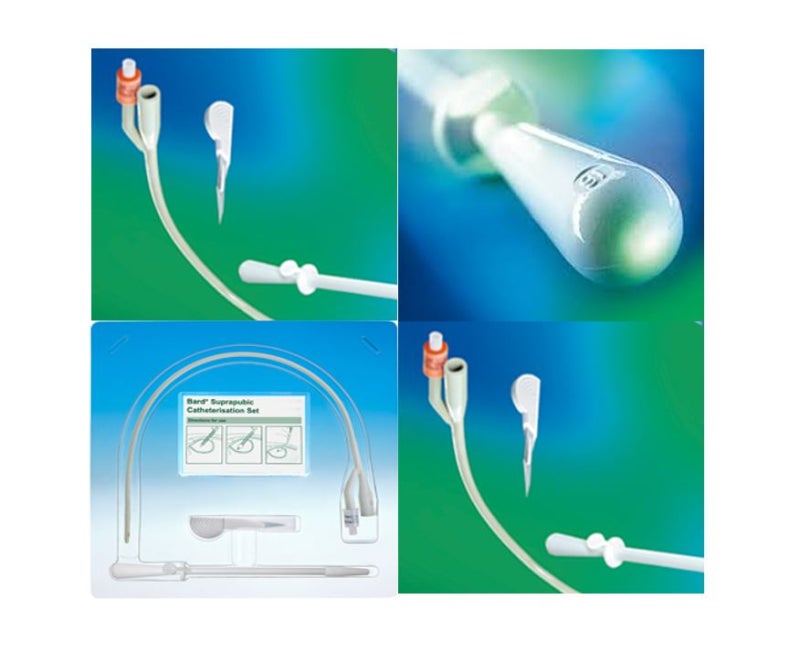 치골 상부 도뇨관 삽입술(Suprapubic urinary catheter) : 네이버 블로그
