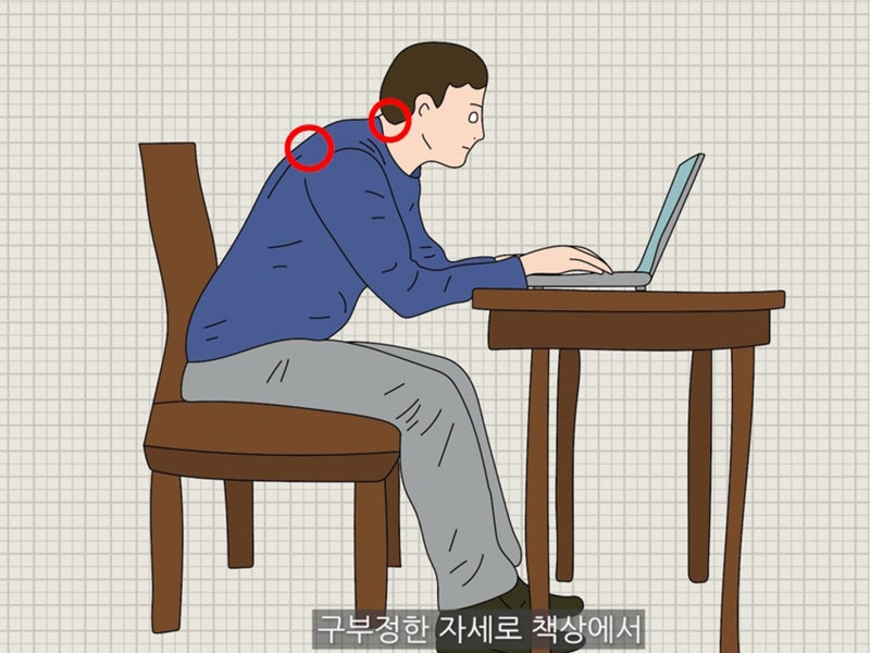 근막통증증후군 증상 및 치료담 걸렸을 때 만성 근육통 원인 걸리는 이유 네이버 블로그
