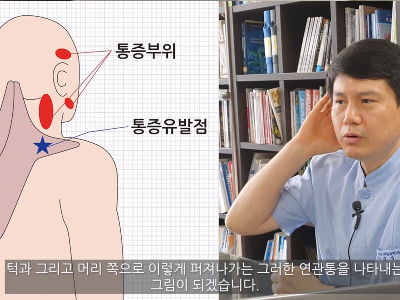 근막통증증후군 증상 및 치료담 걸렸을 때 만성 근육통 원인 걸리는 이유 네이버 블로그