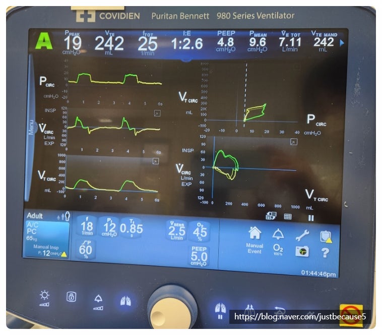 인공호흡기 화면의 이해_PB980 : 네이버 블로그