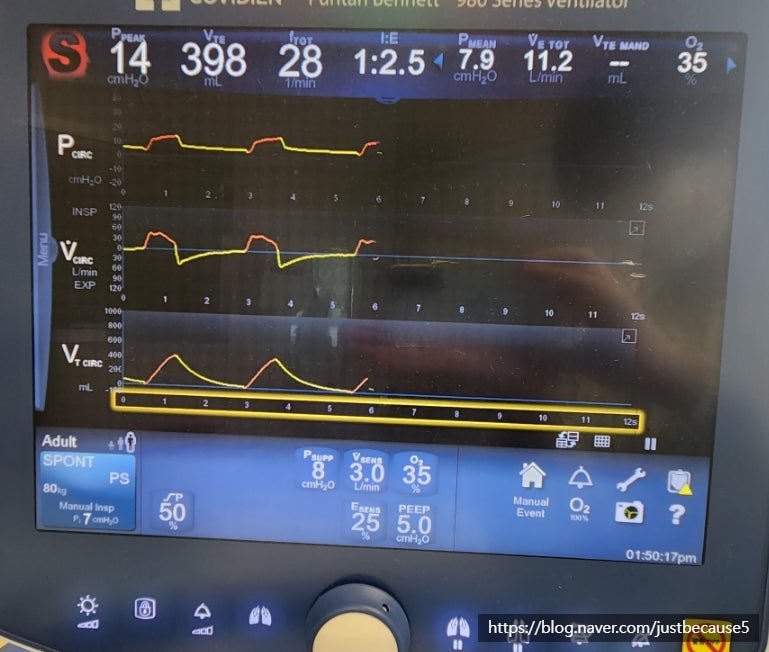 인공호흡기 화면의 이해_PB980 : 네이버 블로그
