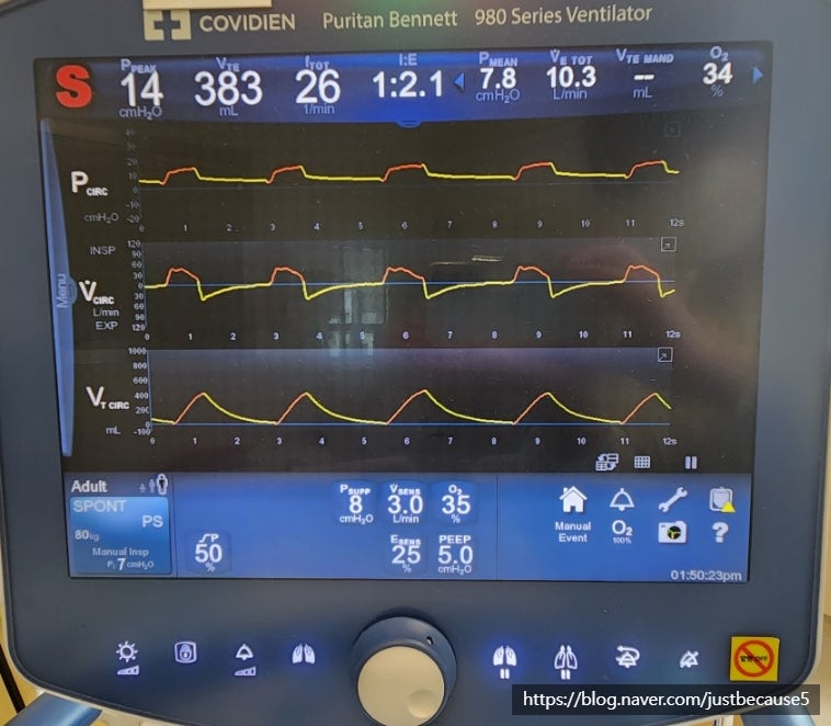 인공호흡기 화면의 이해_PB980 : 네이버 블로그