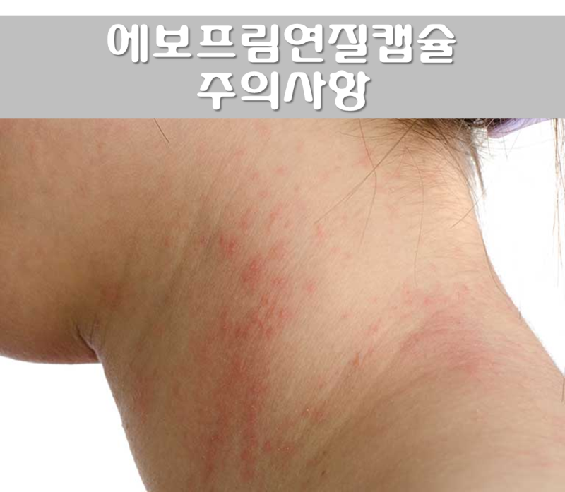 에보프림연질캡슐 아토피습진 가려움 당뇨신경병증 에보프림 효능 효과 복용법 부작용 주의사항 가격 네이버 블로그