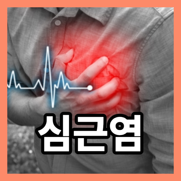 심근염 증상과 원인 치료 급성 심근염 검사~