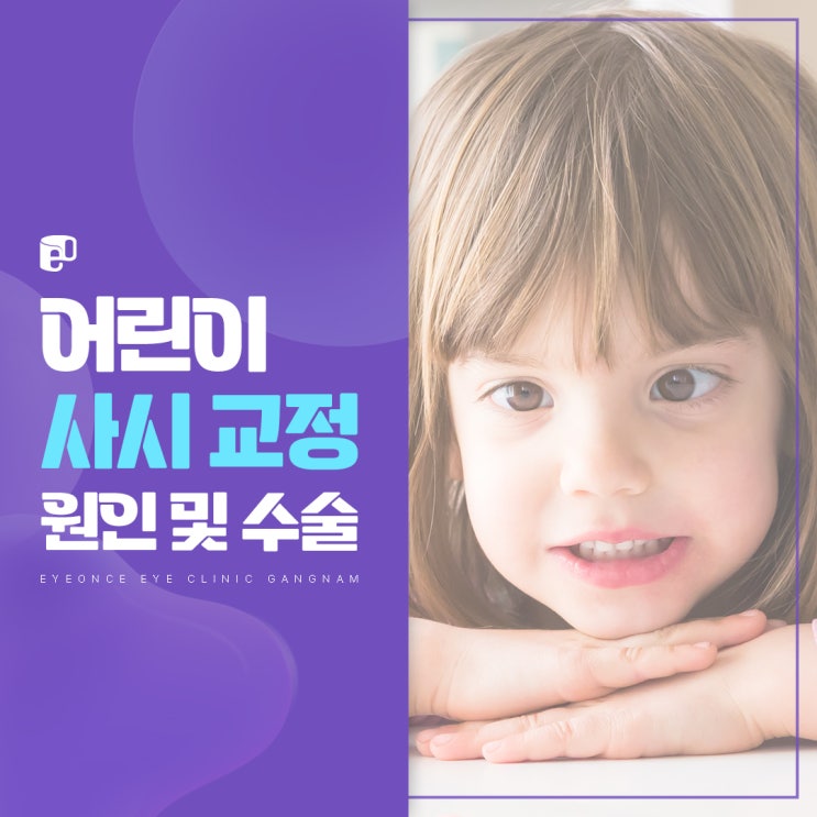 어린이 사시 교정 원인 증상 수술 치료 시기 신사동안과