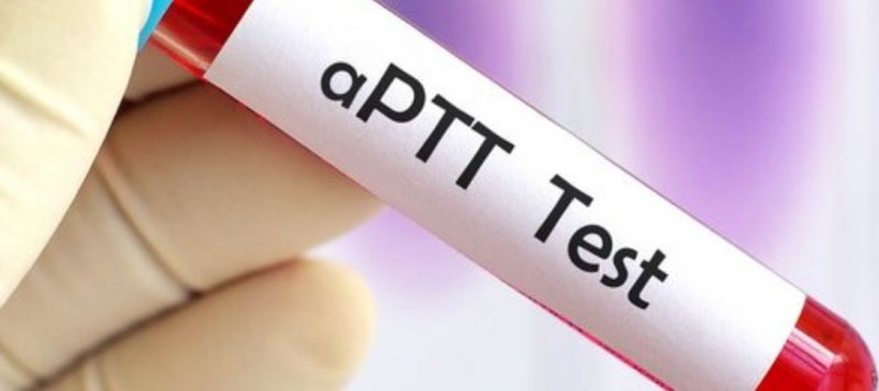 혈액응고검사란 무었일까? INR aPTT PT BT 수치와 채혈방법 및 임상적 의의 Wafarin, aspirin 등 항응고요법 사용 약물 알아보기 : 네이버 블로그