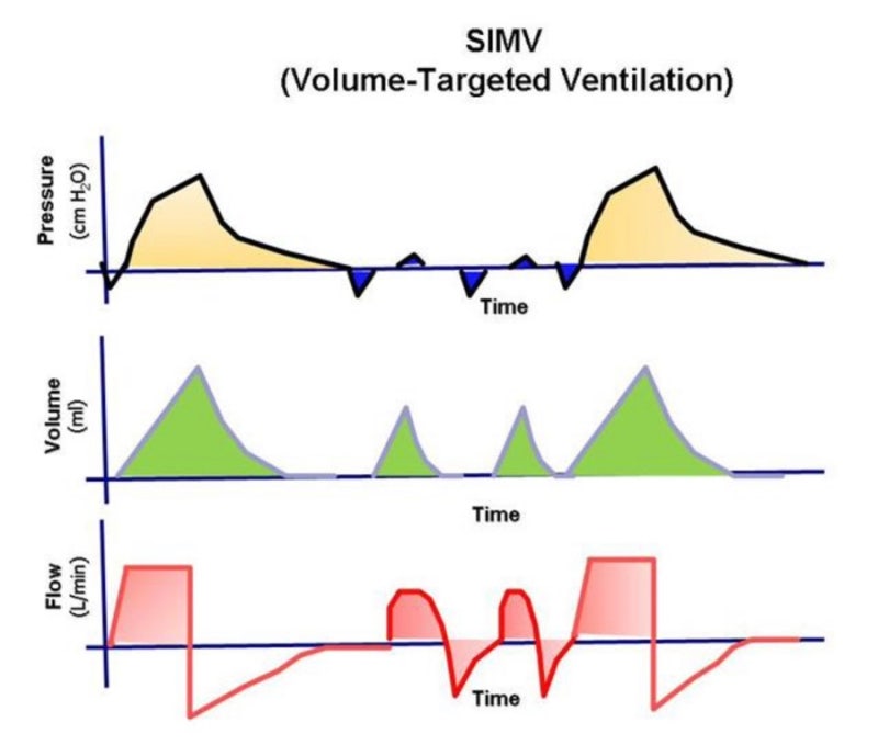 벤틸레이터 모드 - SIMV 공부하기 : 네이버 블로그