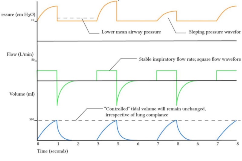 벤틸레이터 모드 - SIMV 공부하기 : 네이버 블로그
